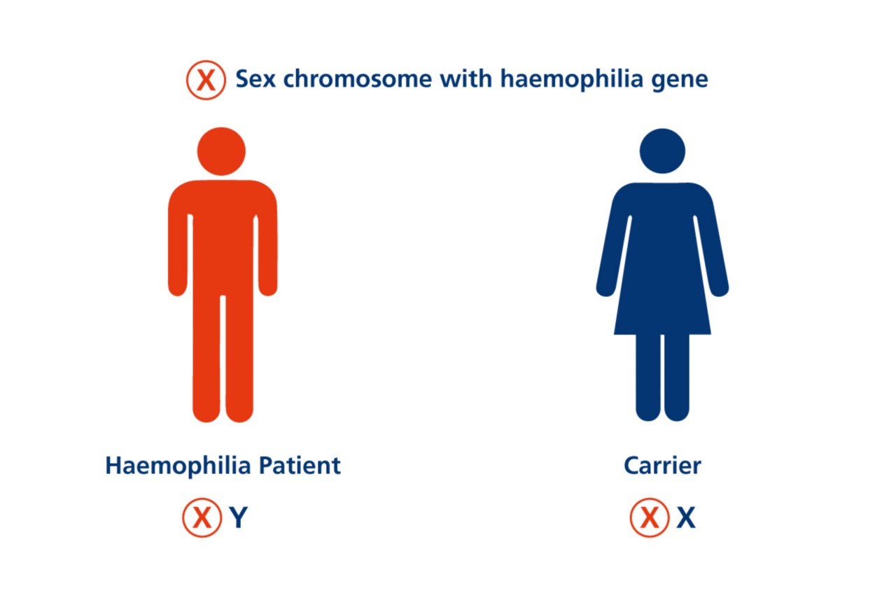 Understanding Haemophilia